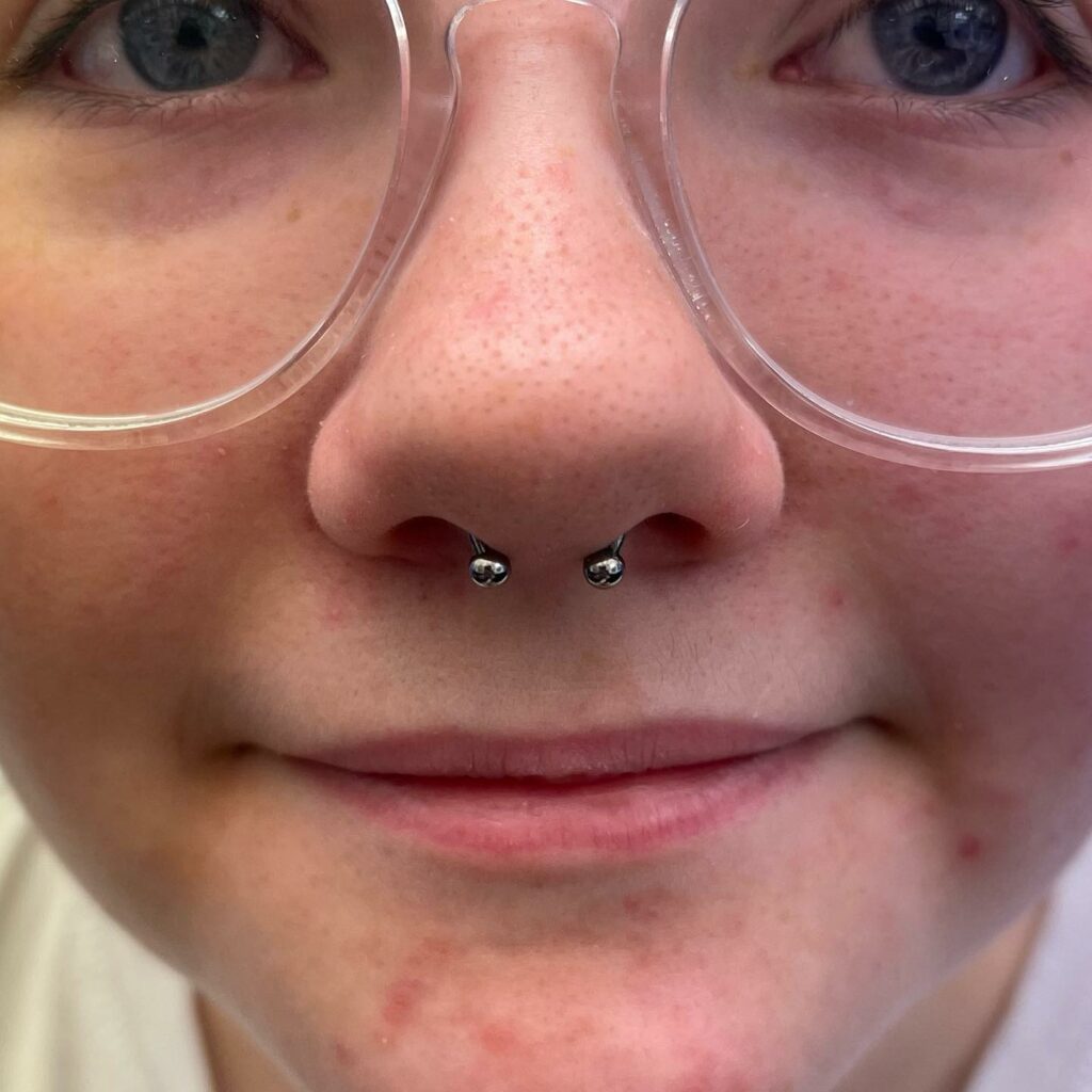 The most satisfying, tiny little septum for Brodie 🩷 Thank you for your ...